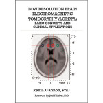Low Resolution Brain Electromagnetic Tomography (LORETA)